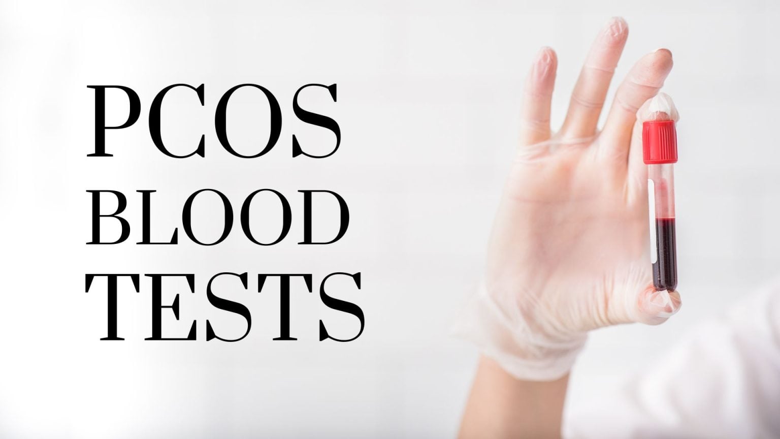 12 Essential PCOS Blood Tests for Your Health Journey